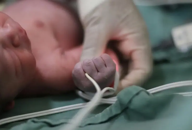 Understanding Forceps Delivery Birth Injuries And Your Legal Rights ...